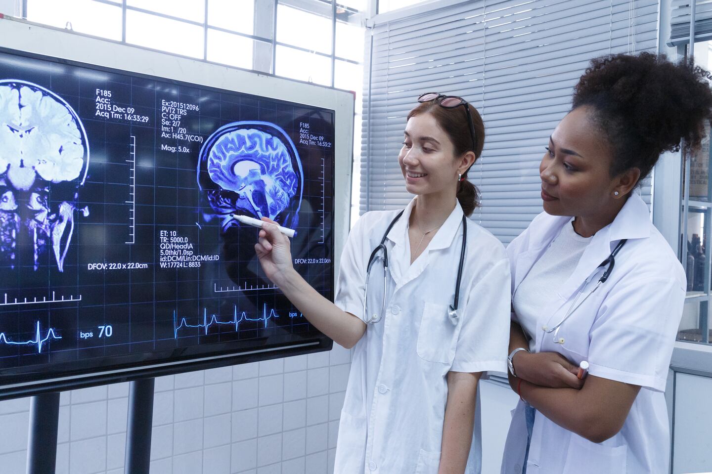 La adolescencia dura hasta los 32 años: Estudio de Cambridge – FayerWayer