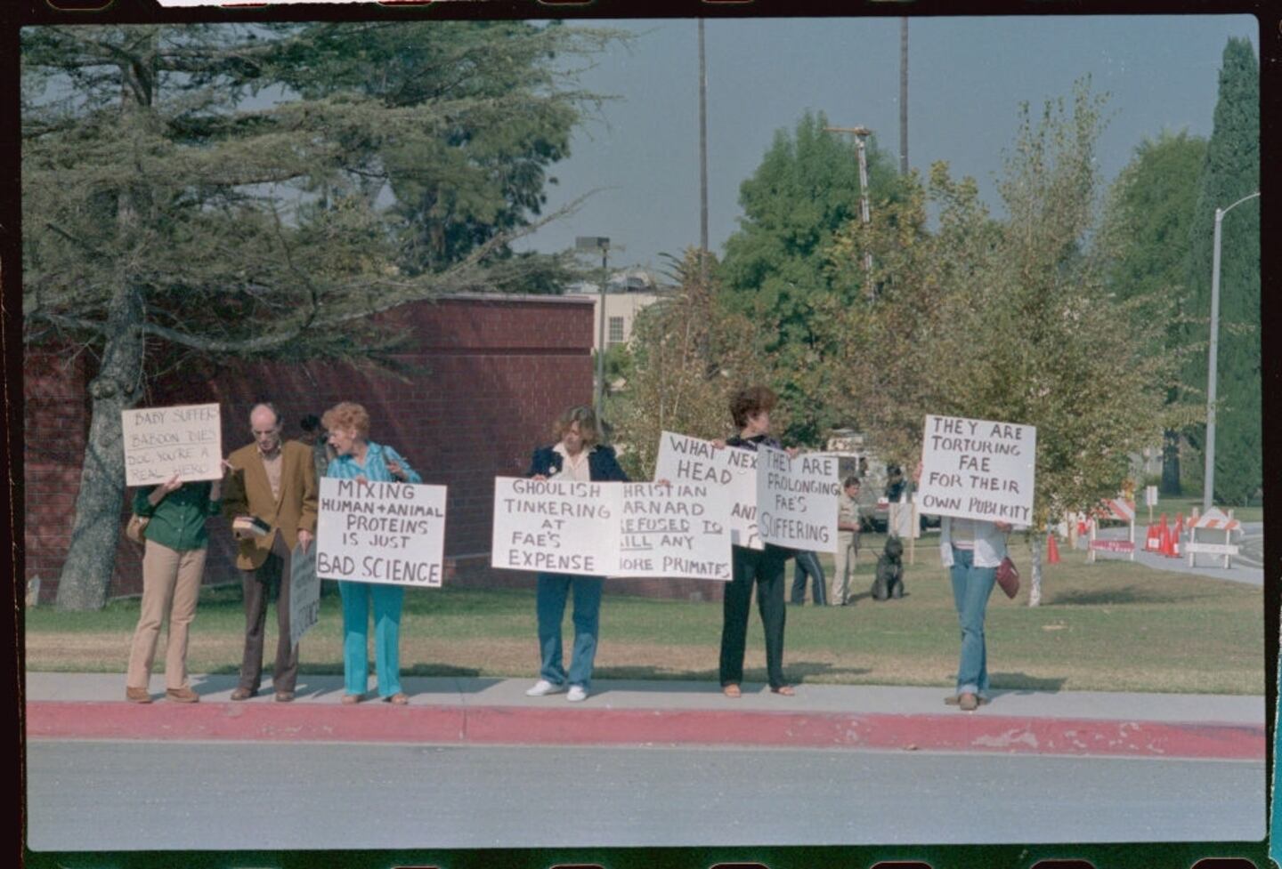 Antes del corazón de un cerdo, se probó con uno de babuino: recordamos ...